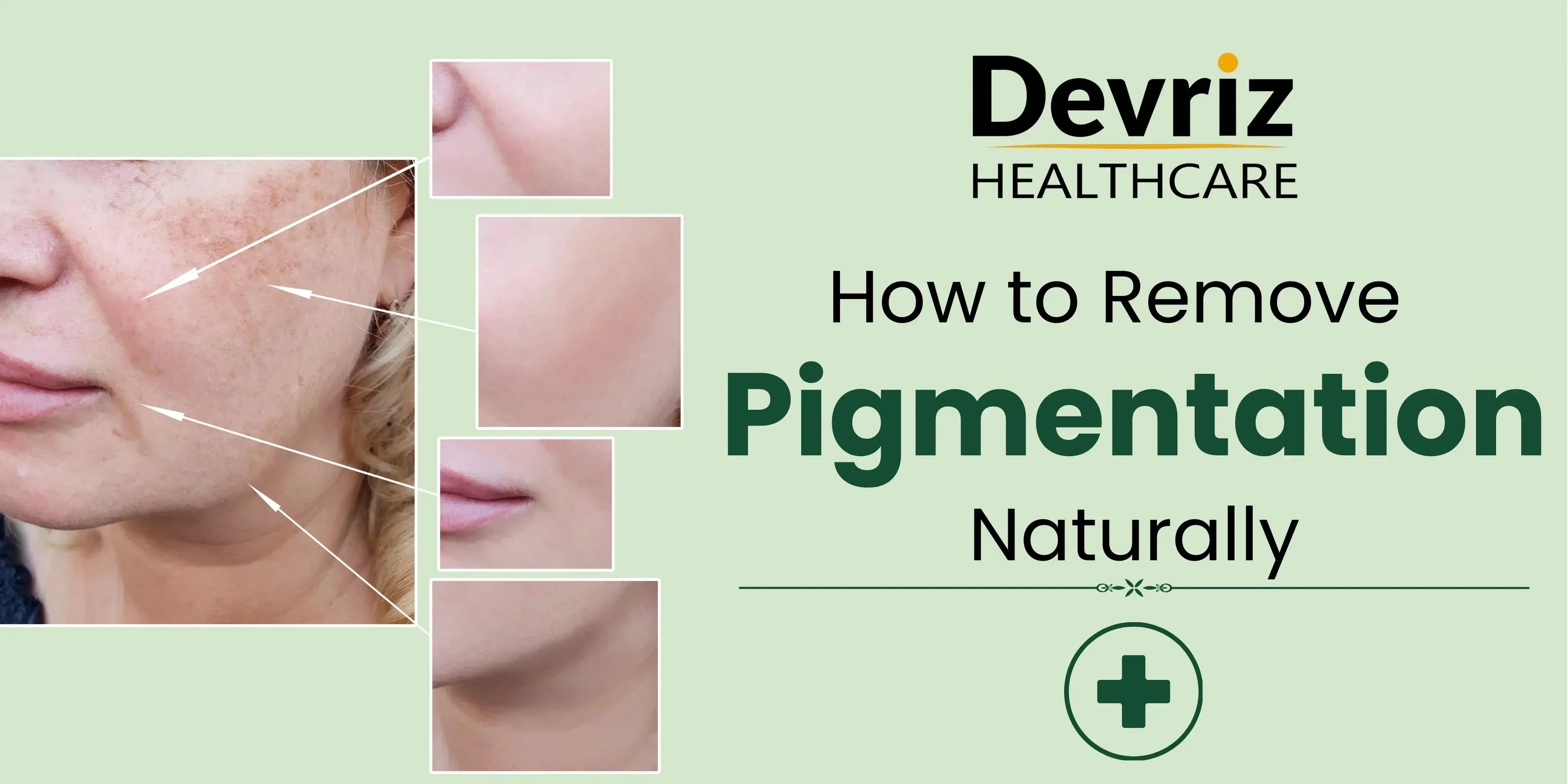 How to Remove Pigmentation Naturally 2025 | Skincare Guide | Devriz ...