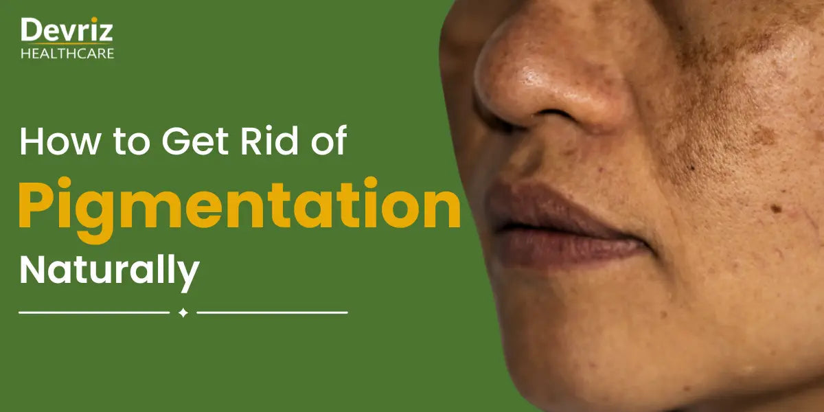 Rid of Pigmentation Naturally From Skin 2025 | Devriz Healthcare
